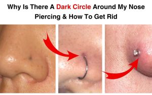 Why Is There A Dark Circle Around My Nose Piercing & How To Get Rid